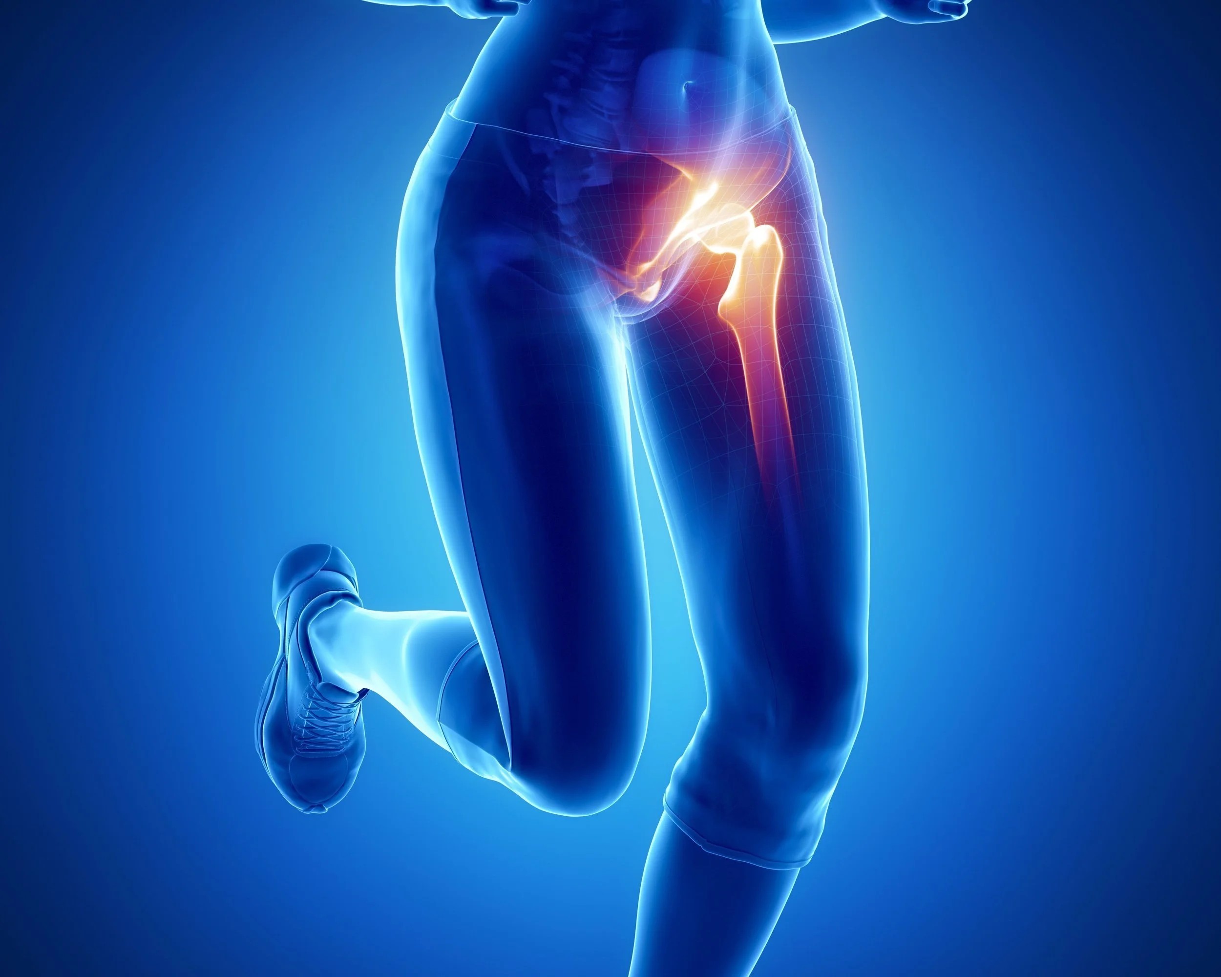 Hip Impingement Treatment in Singapore | Dr. Dinesh Sports Dr